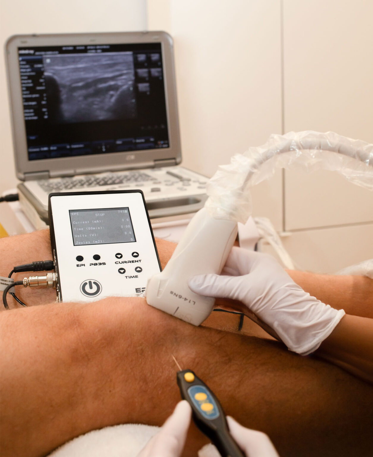 EPI - Aris Fisioterapia - Fisioterapia y salud